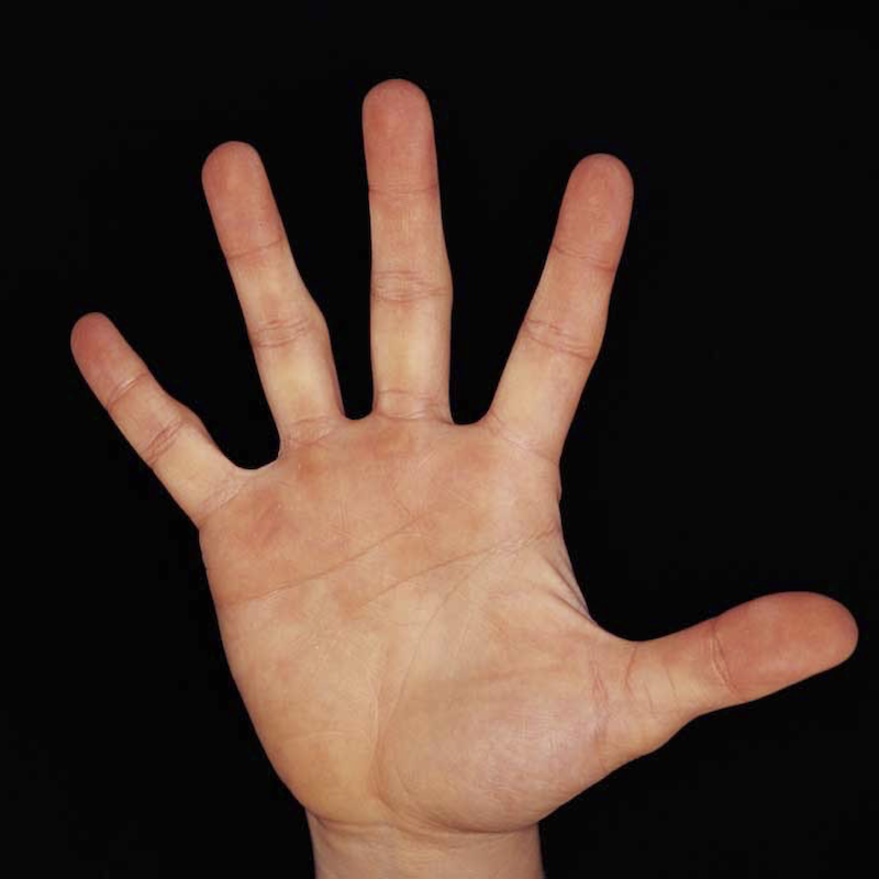 Five Years On, One Big Theme